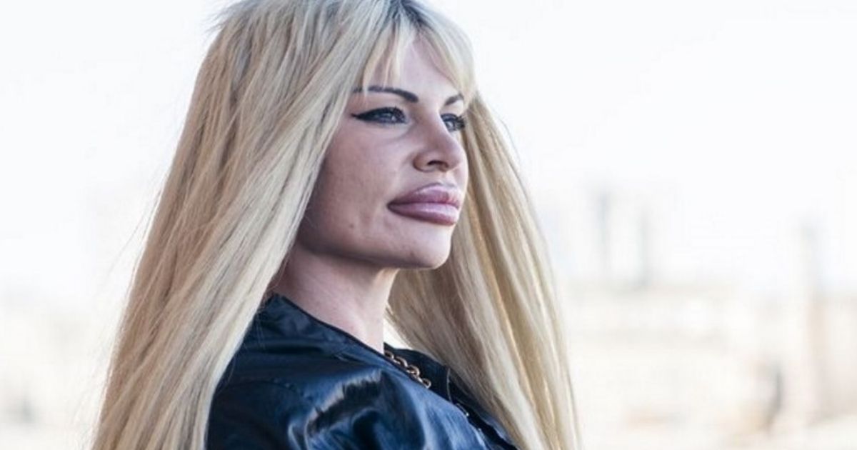 Taip susidomėjo plastine chirurgija, kad prarado vyrą ir įgijo keistus ...